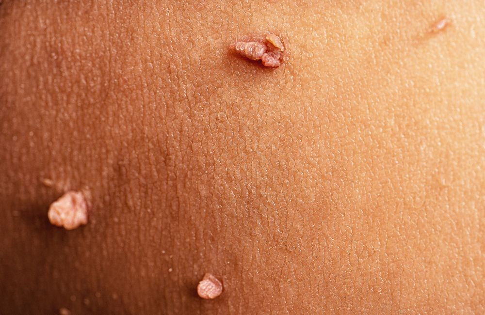 BE VERY CAREFUL . If you get this, you are infected with …. See more ...